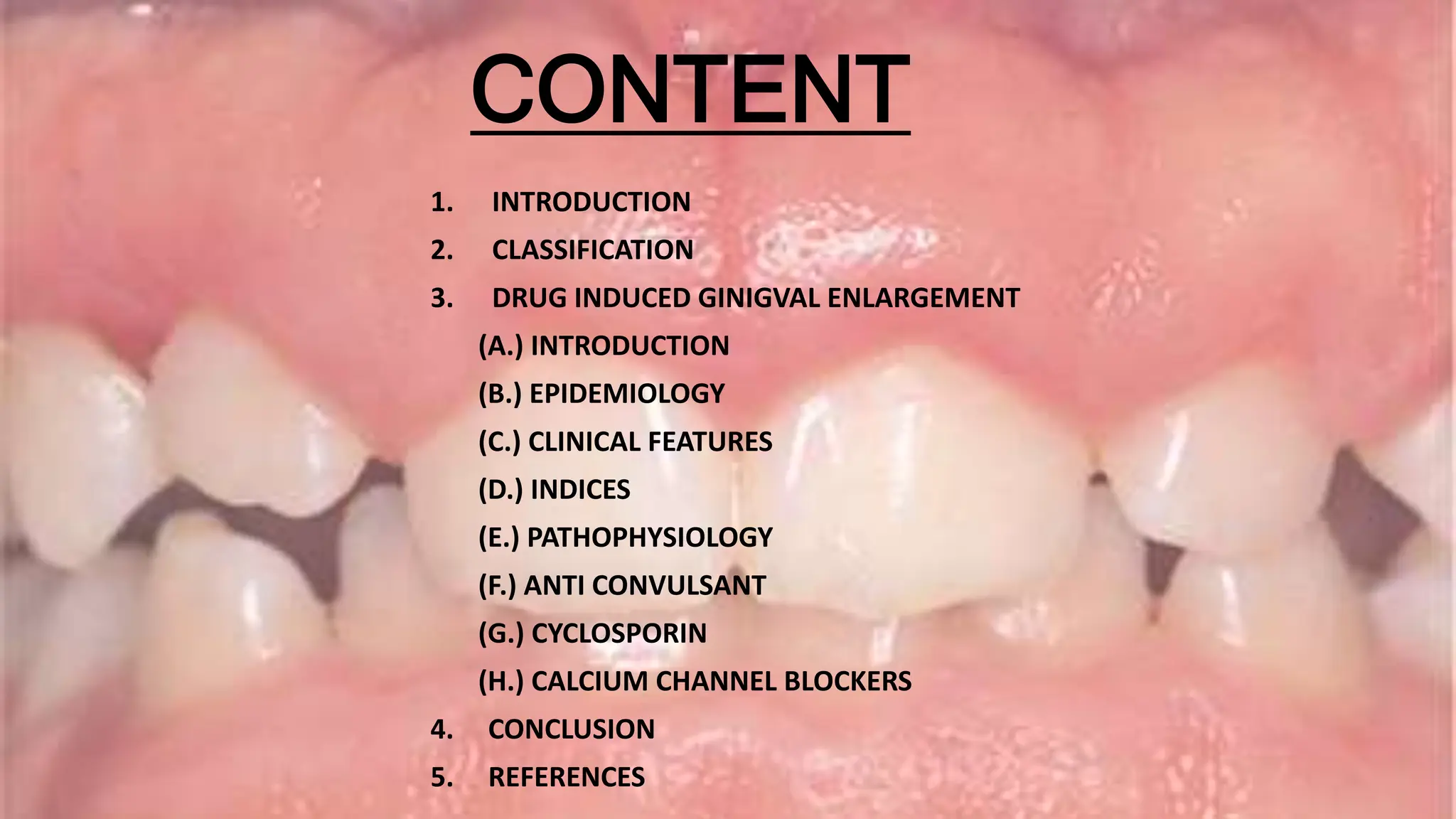 Drug induced gingival enlargement - DIGO | PPTX