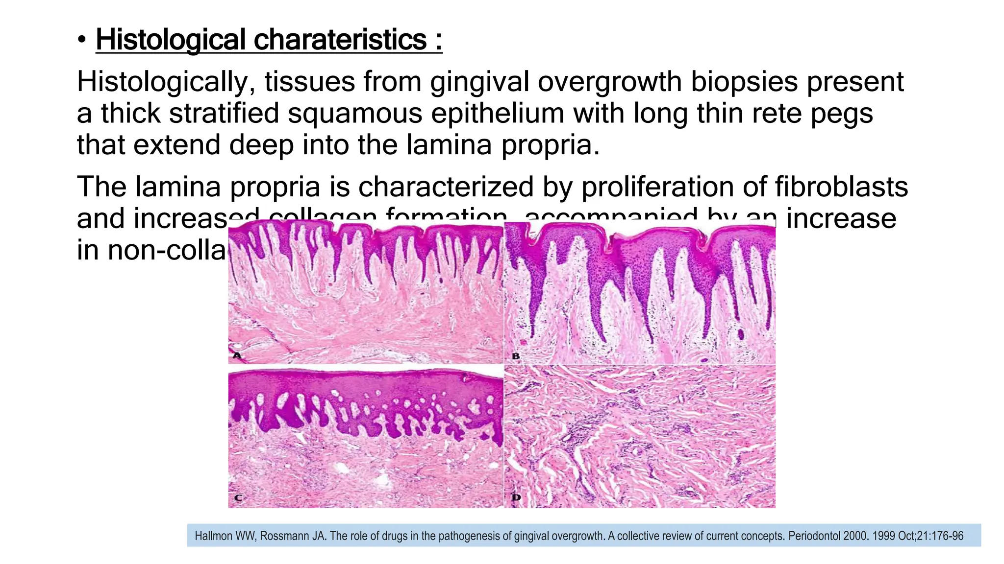 Drug induced gingival enlargement - DIGO | PPTX
