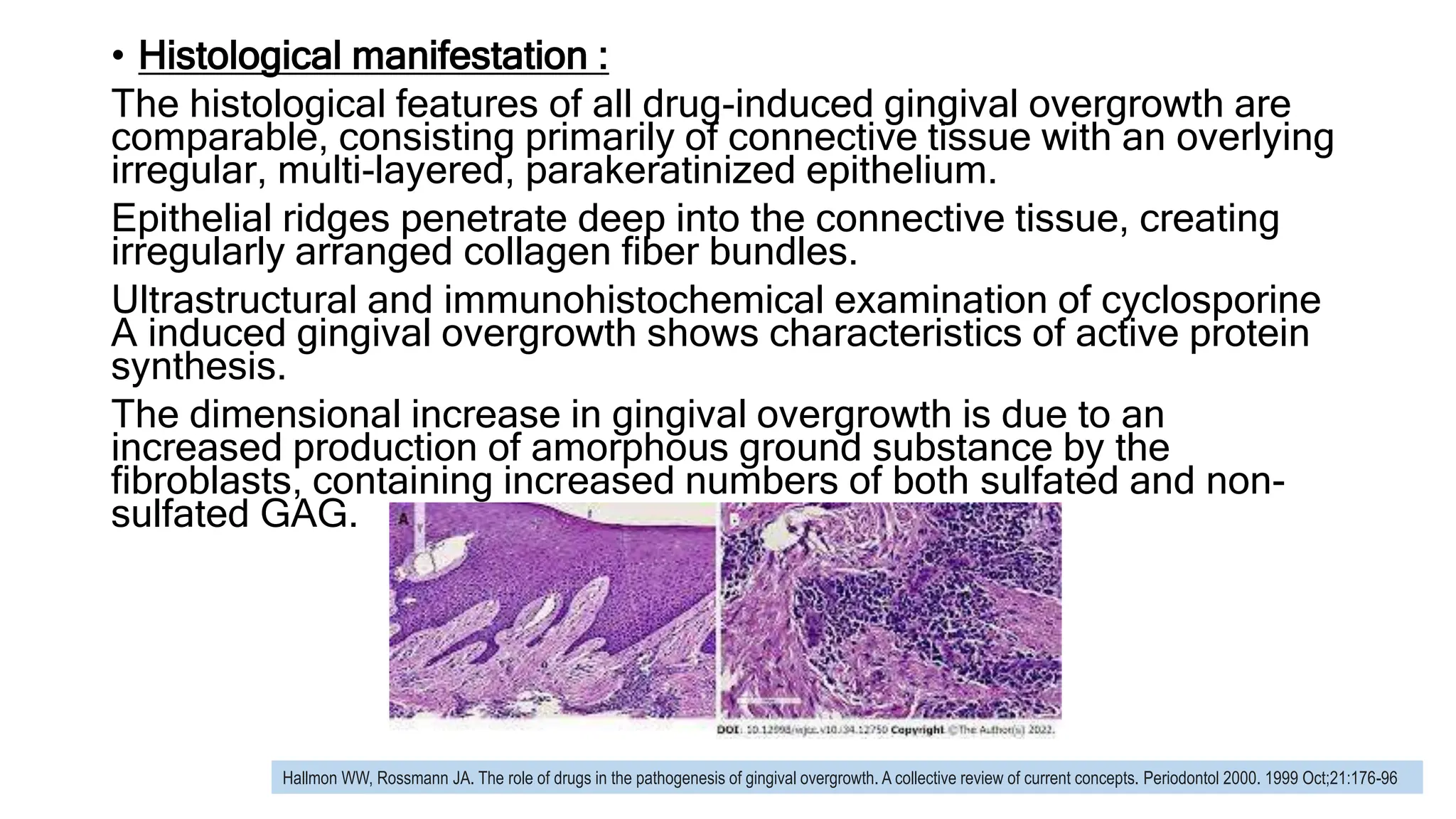 Drug induced gingival enlargement - DIGO | PPTX