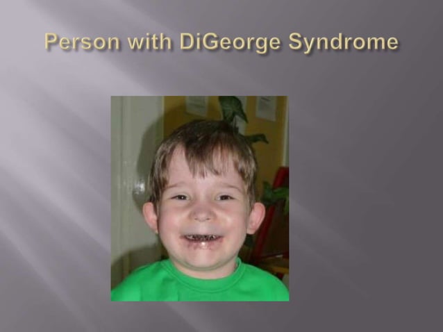 Di george syndrome