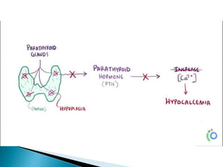 Digeorge syndrome | PPTX