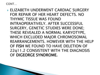 Digeorge syndrome | PPTX | Thyroid Disorders | Endocrine and Metabolic ...