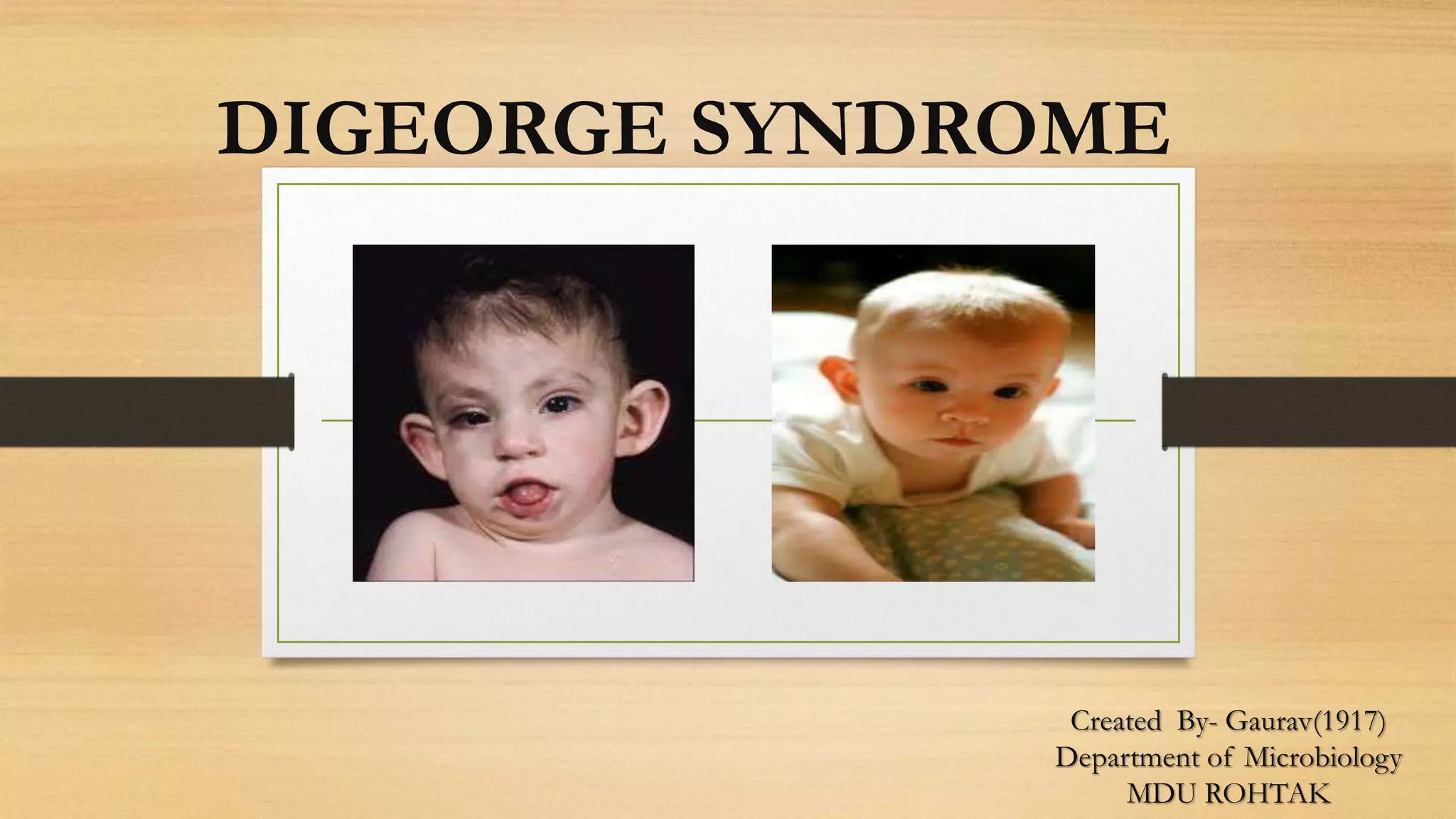 Digeorge syndrome | PPT