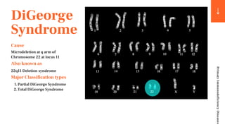 DiGeorge Syndrome aparajeya shanker | PDF