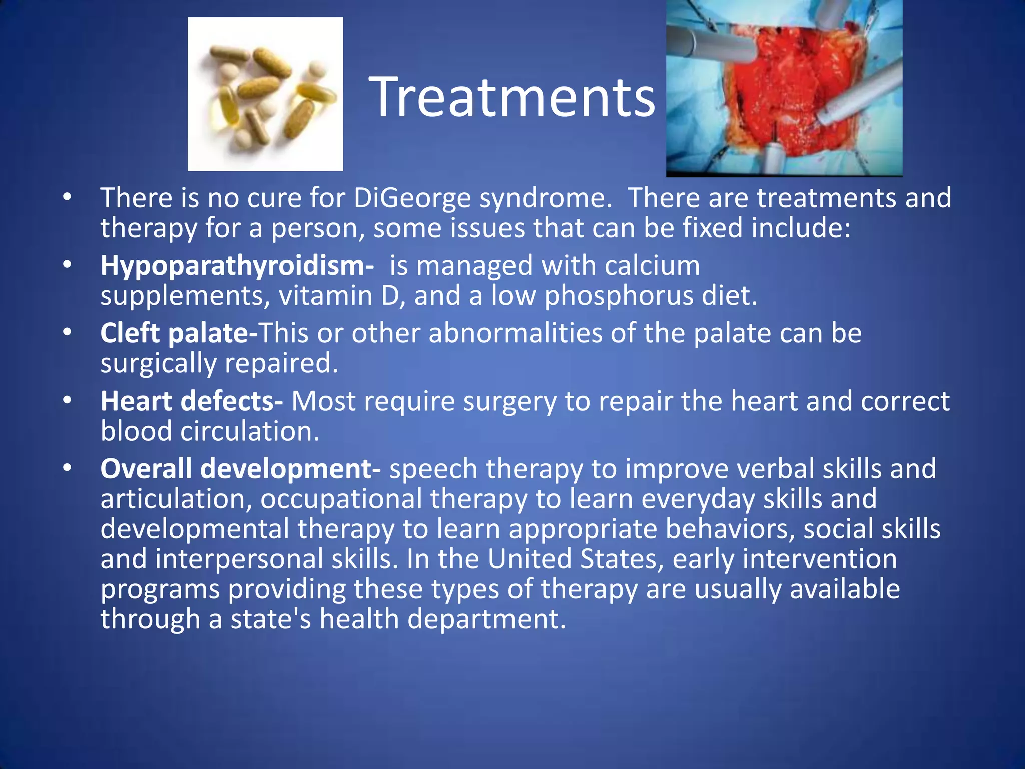 Di george syndrome (dgs) | PPTX