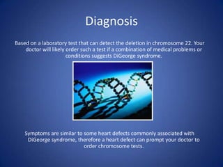 Di george syndrome (dgs) | PPTX | Blood Disorders | Diseases and Conditions