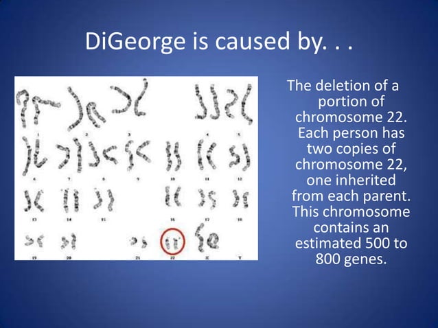Di george syndrome (dgs) | PPTX | Blood Disorders | Diseases and Conditions