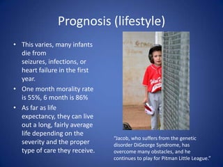 Di george syndrome (dgs) | PPTX | Blood Disorders | Diseases and Conditions
