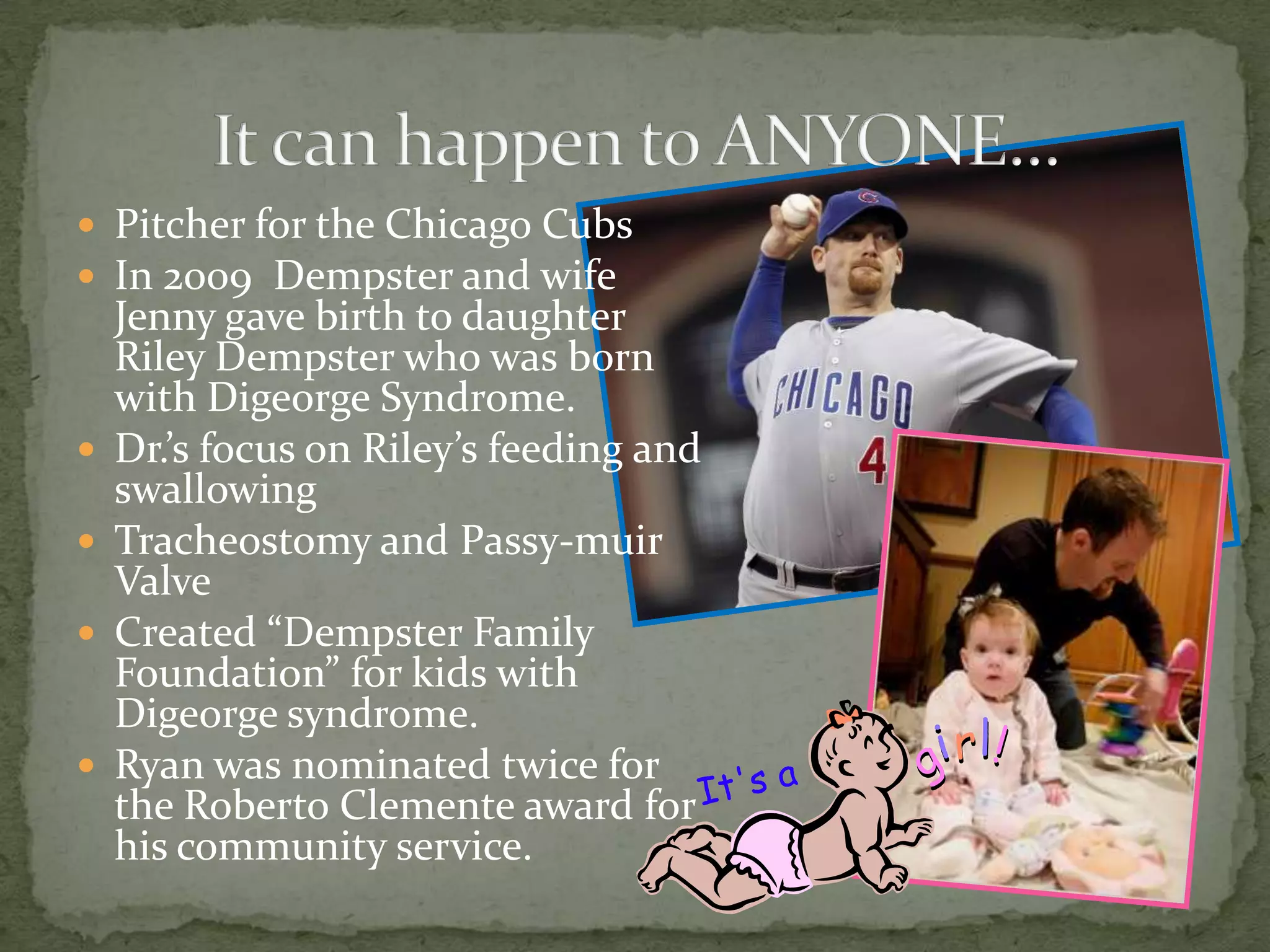 Di george syndrome ppt | PPTX