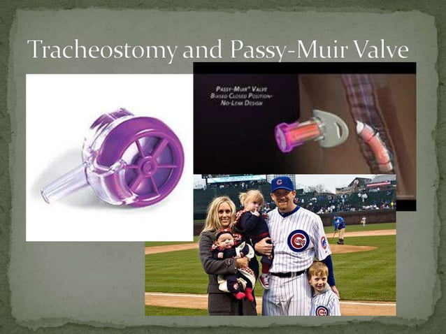 Di george syndrome ppt | PPTX