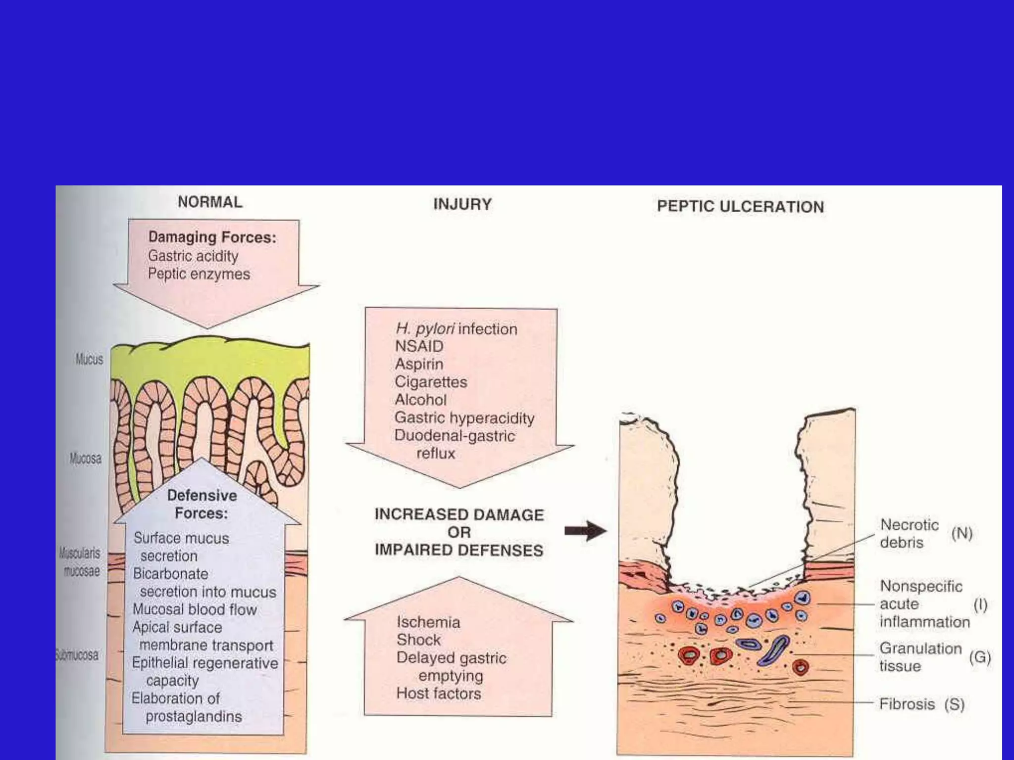 Digestion failure.pptx