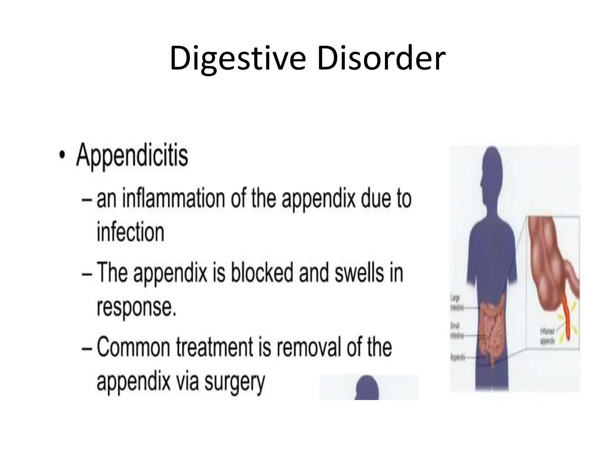DIGESTIVE SYSTEM"S Digestive-Disorder.pptx