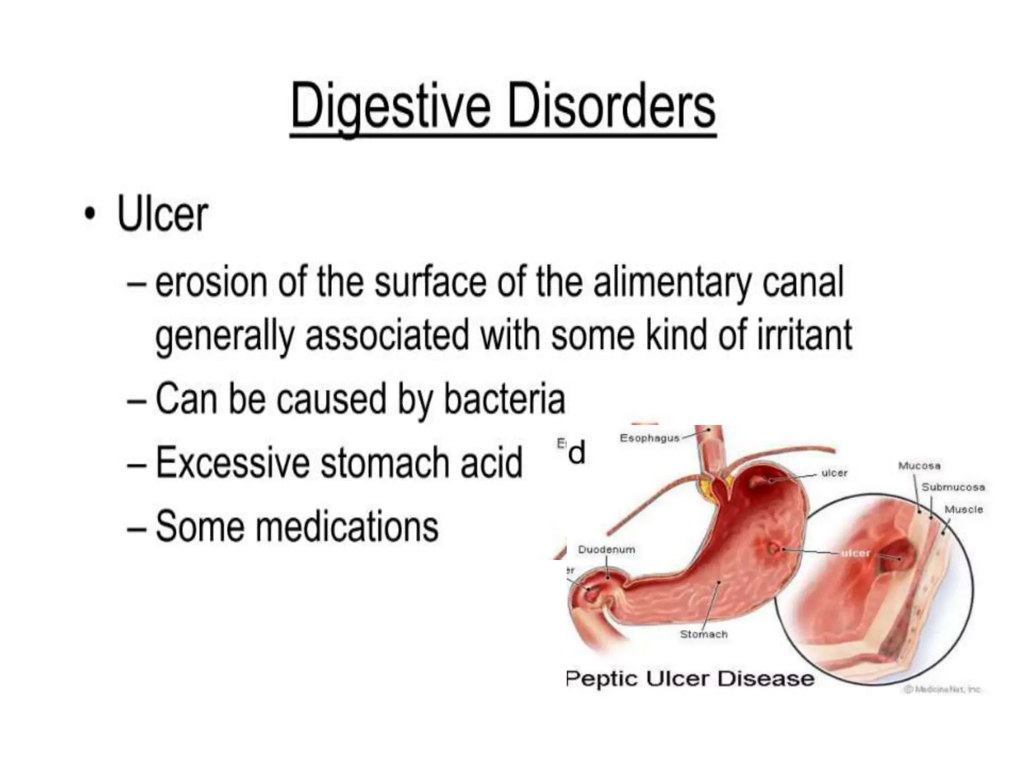 DIGESTIVE SYSTEM"S Digestive-Disorder.pptx