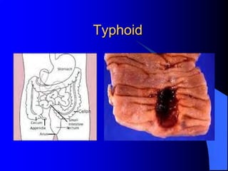 Digestive disorders! How they present? | PDF | Digestive Disorders ...