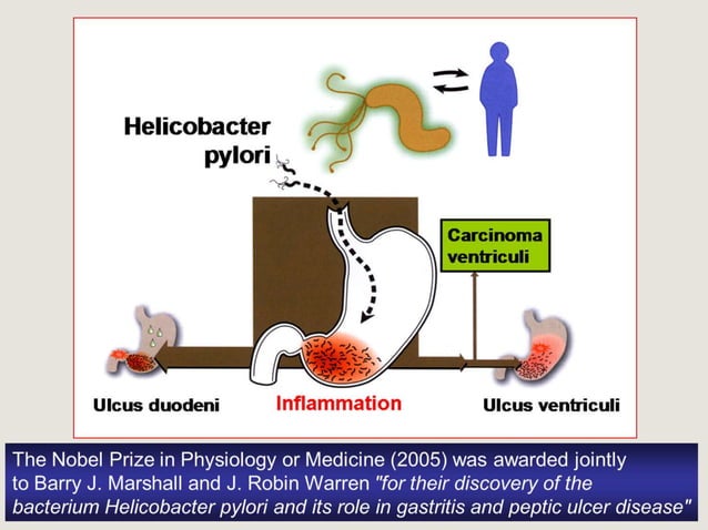 Drugs to treat digestive disorders in ruminants | PPTX