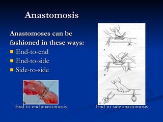 Colonoscopy, Hematochezia, Cachexia, Anastomosis | PPT