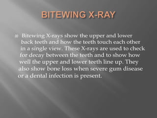 Digestive system | PPTX | Dental Health | Diseases and Conditions