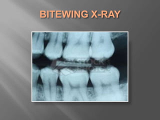 Digestive system | PPTX | Dental Health | Diseases and Conditions