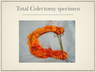 Digestive system medical terminology | KEY