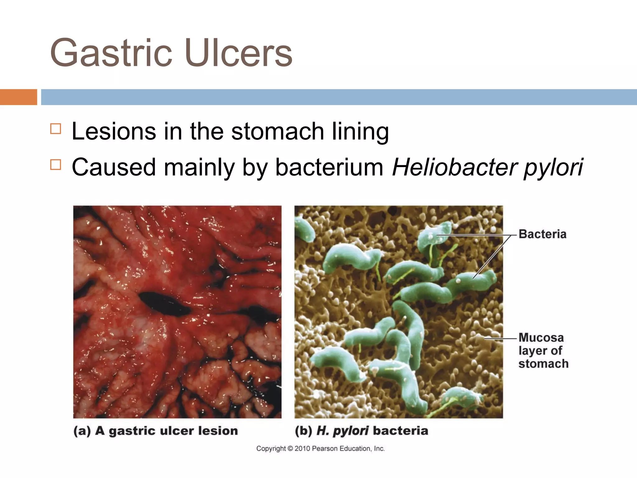 Anatomy & Physiology Lecture Notes - Digestive system | PPT