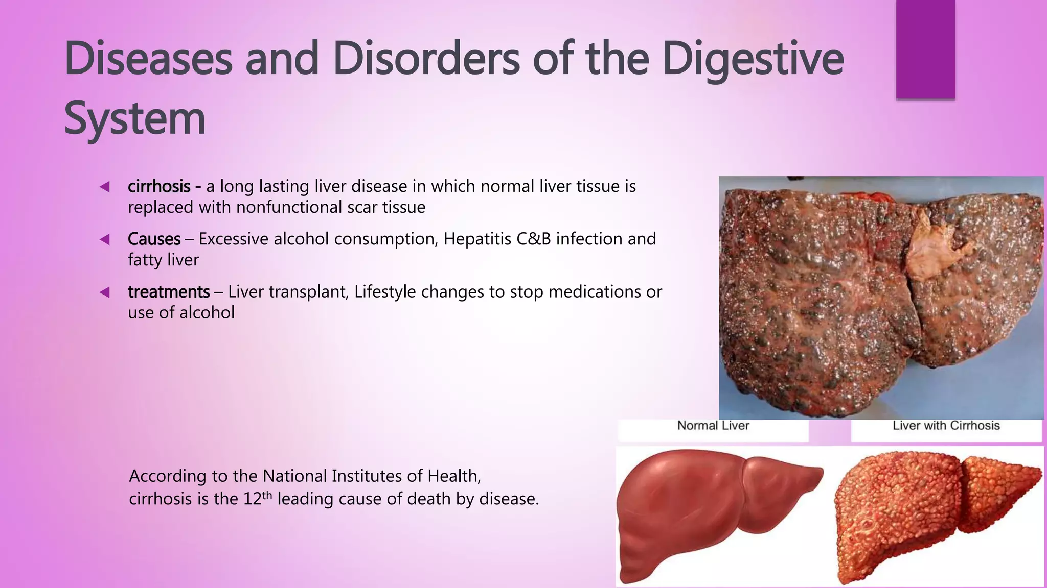 overview of the digestive system and diseases of it | PPT