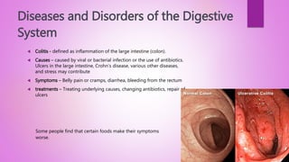 overview of the digestive system and diseases of it | PPTX