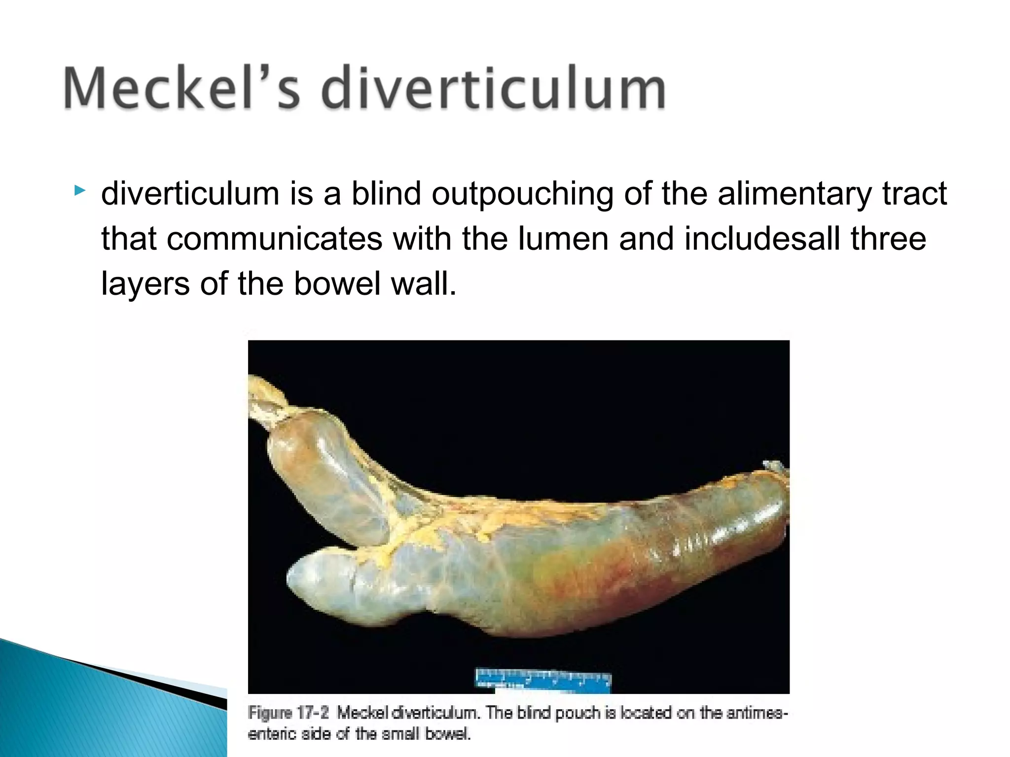 Pathology of the digestive system | PPT