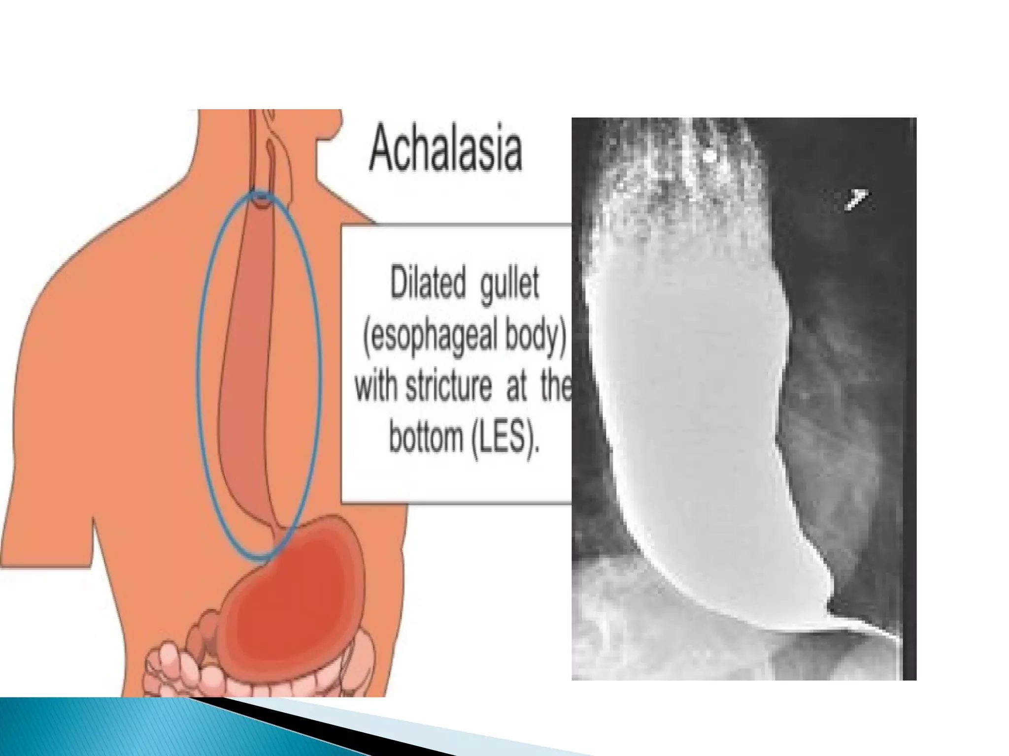 Pathology of the digestive system | PPT