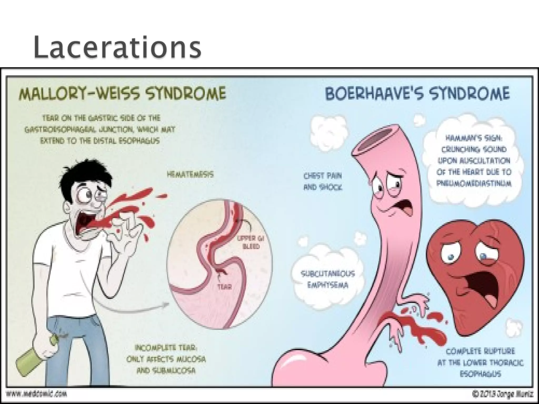 Pathology of the digestive system | PPT