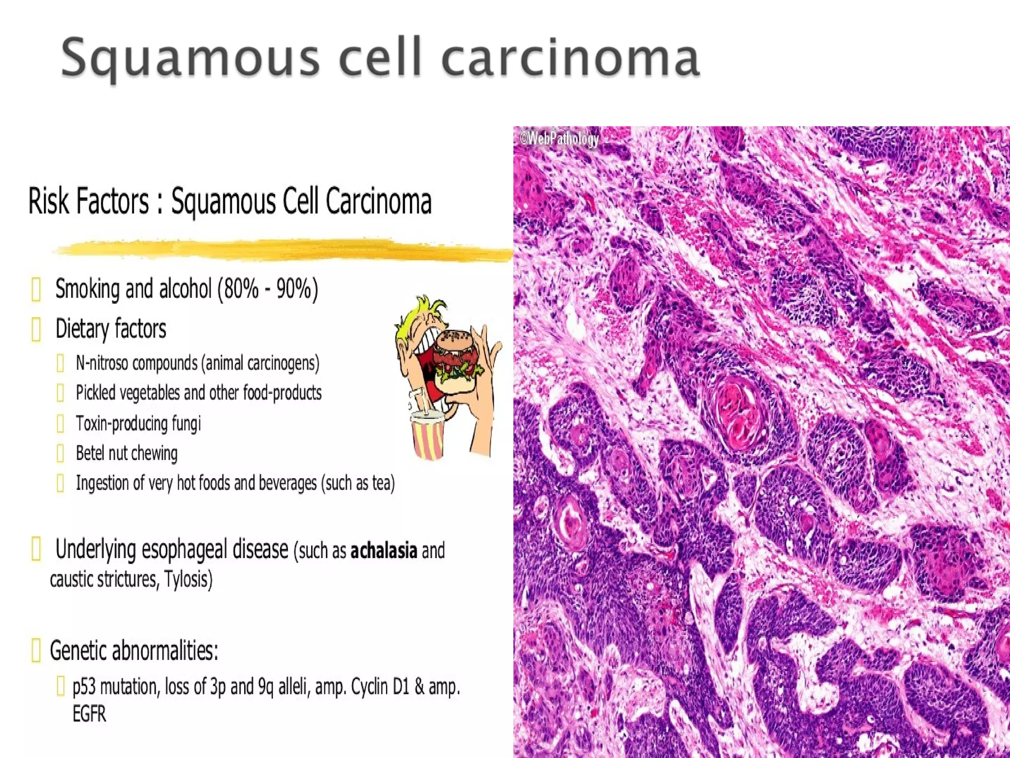Pathology of the digestive system | PPT