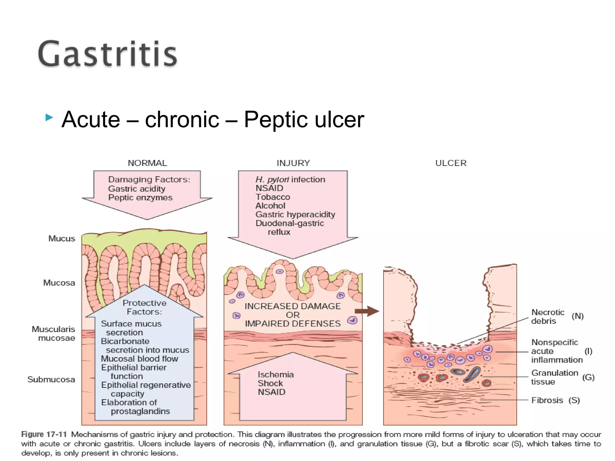 Pathology of the digestive system | PPT