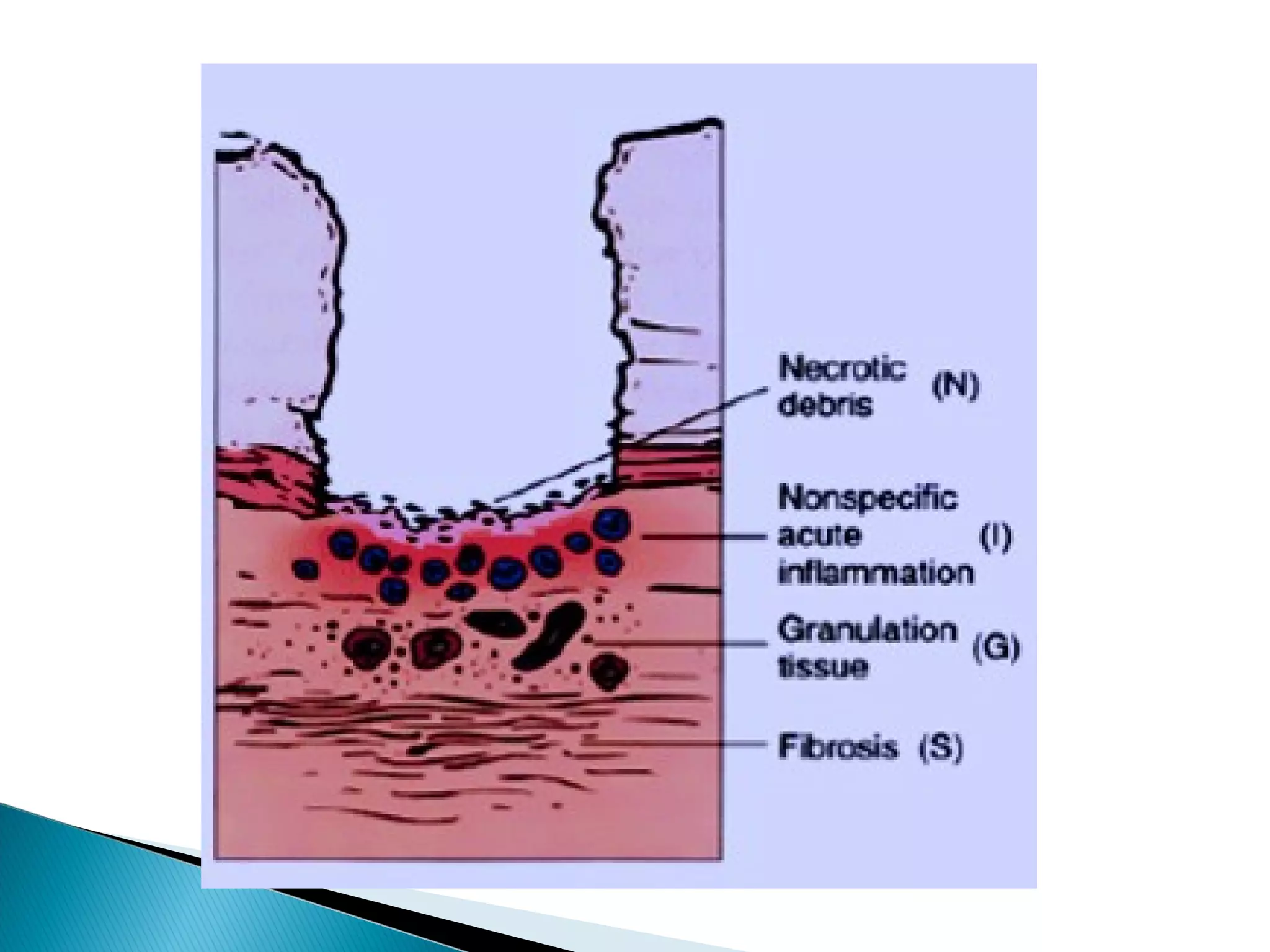 Pathology of the digestive system | PPT