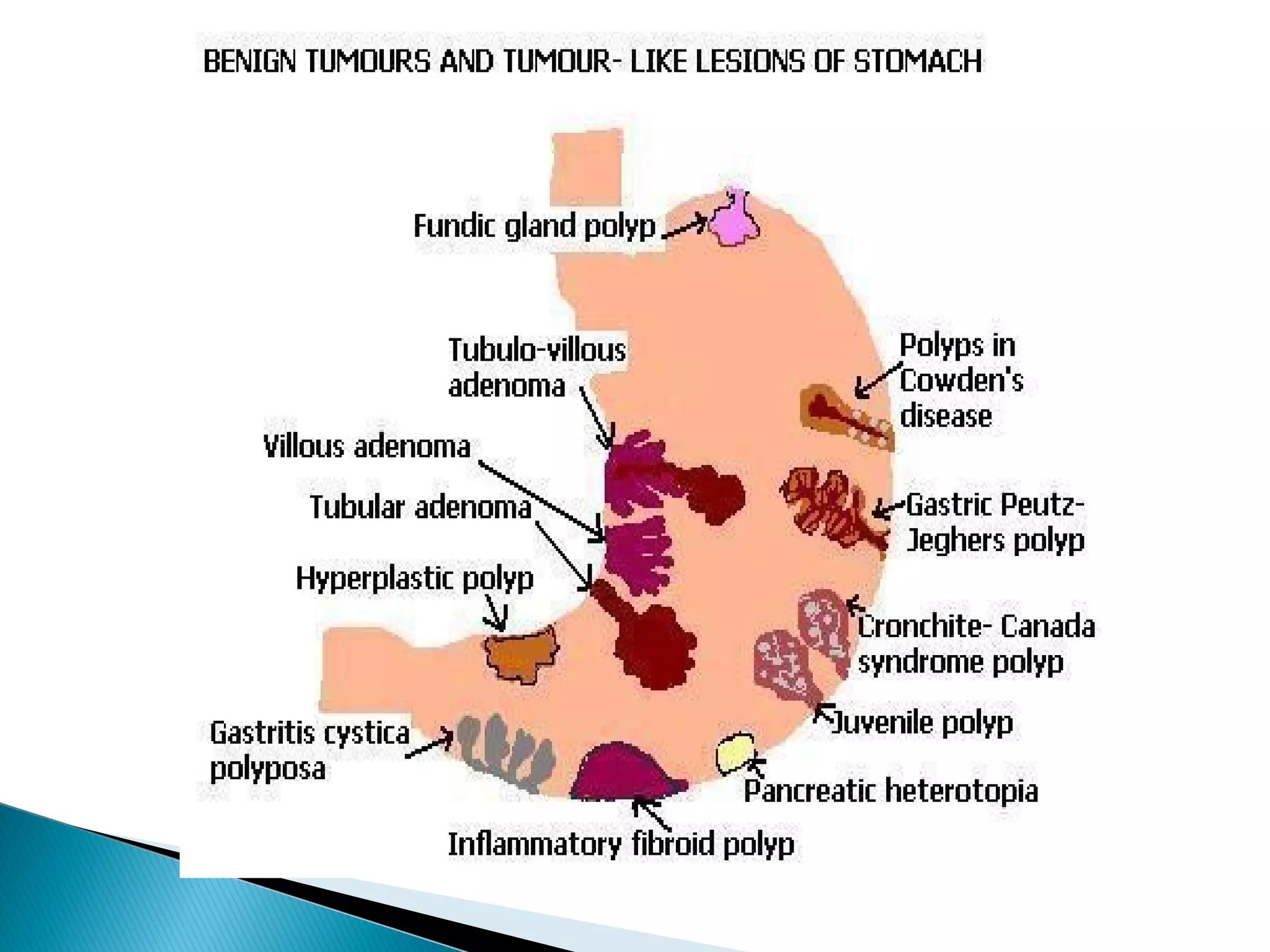 Pathology of the digestive system | PPT