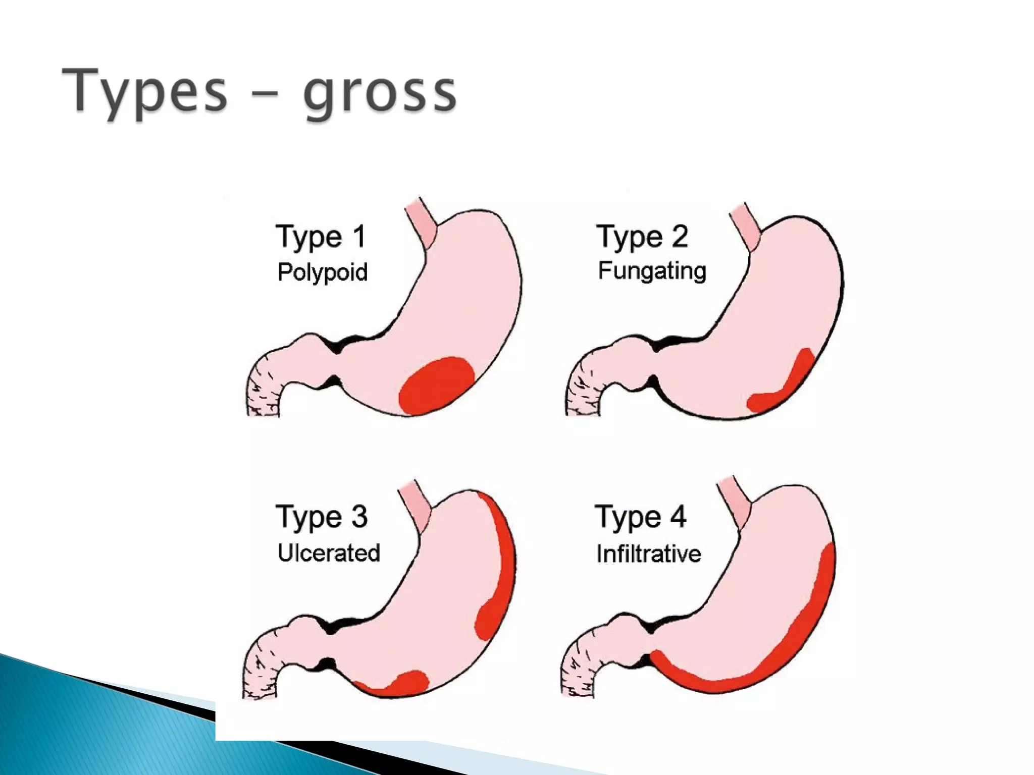 Pathology of the digestive system | PPT