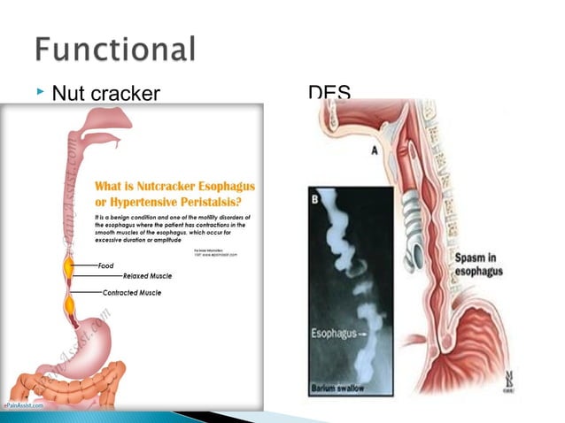 Pathology of the digestive system | PPT
