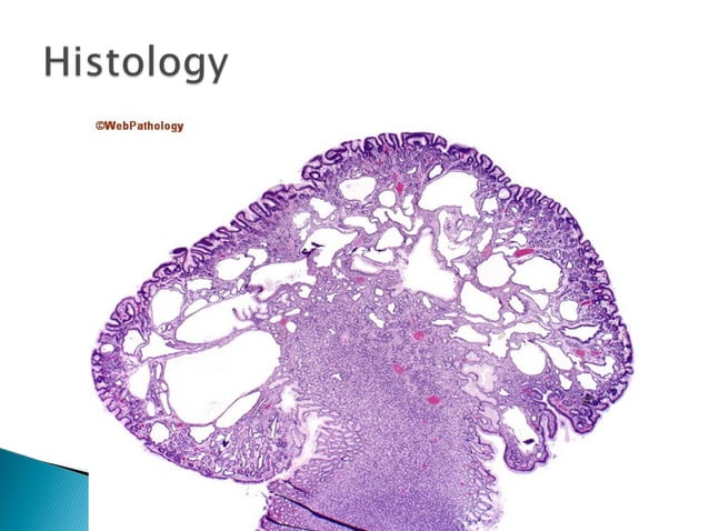 Pathology of the digestive system | PPT