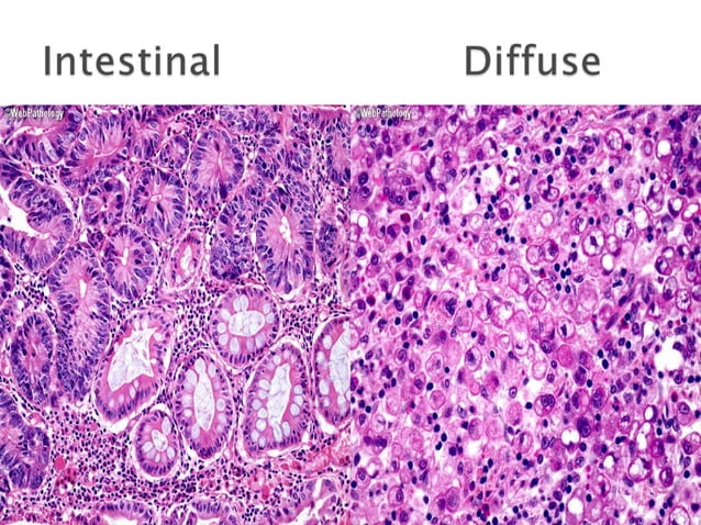 Pathology of the digestive system | PPT
