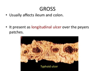 Pathology of the digestive system | PPT