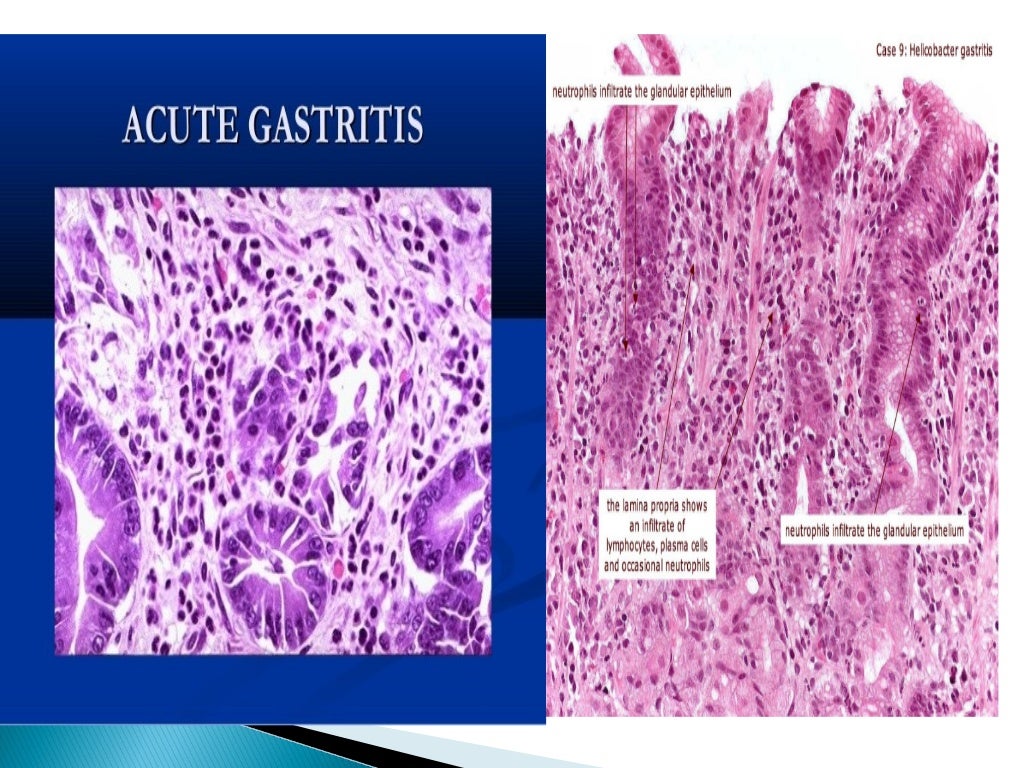 Pathology of the digestive system