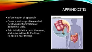 Digestive system | PPT