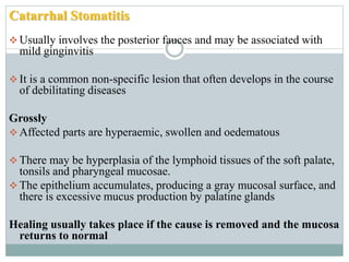Digestive System - Part I.ppt