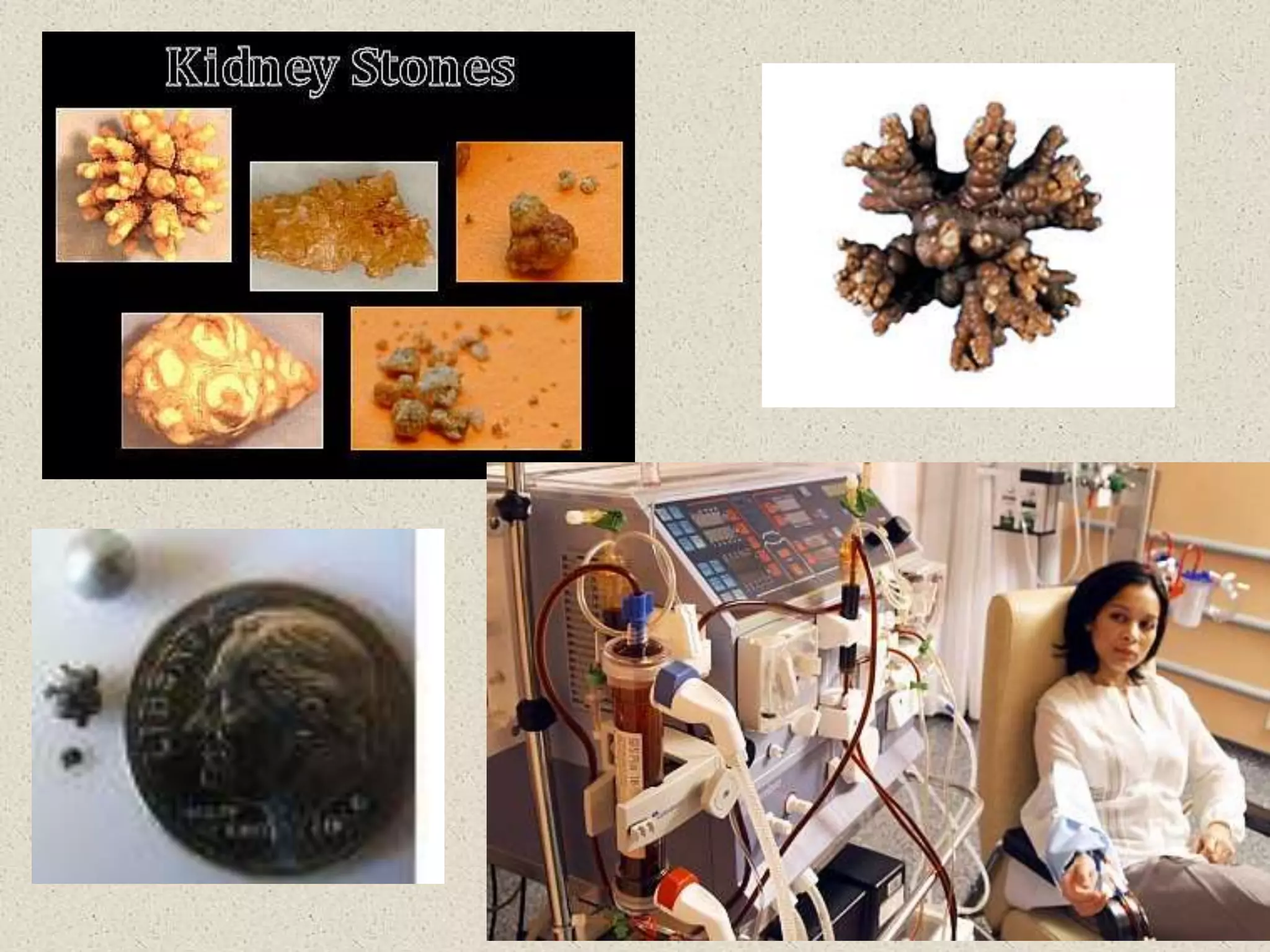 Digestive_systemand_Excretory_System.ppt