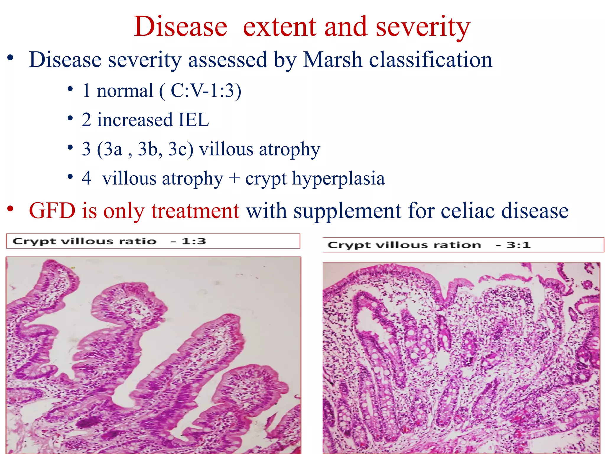 Digestive system and its disease | PPT
