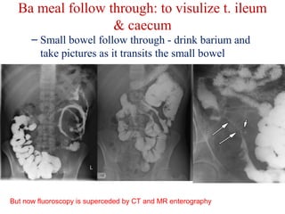 Digestive system and its disease | PPT