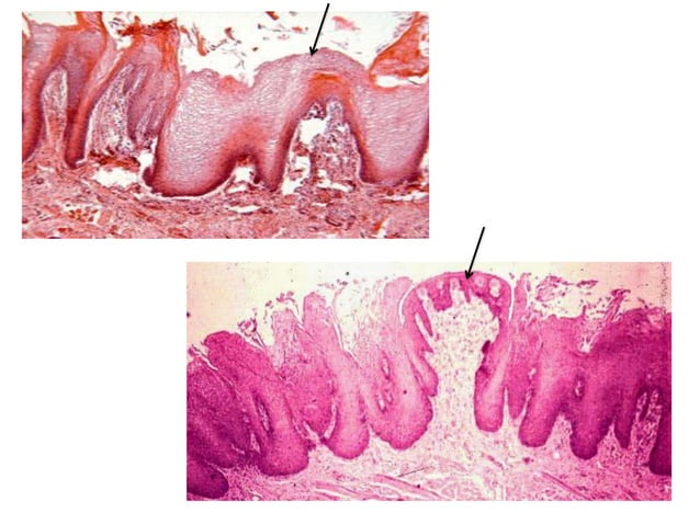histology of Digestive system histology 1 | PPT