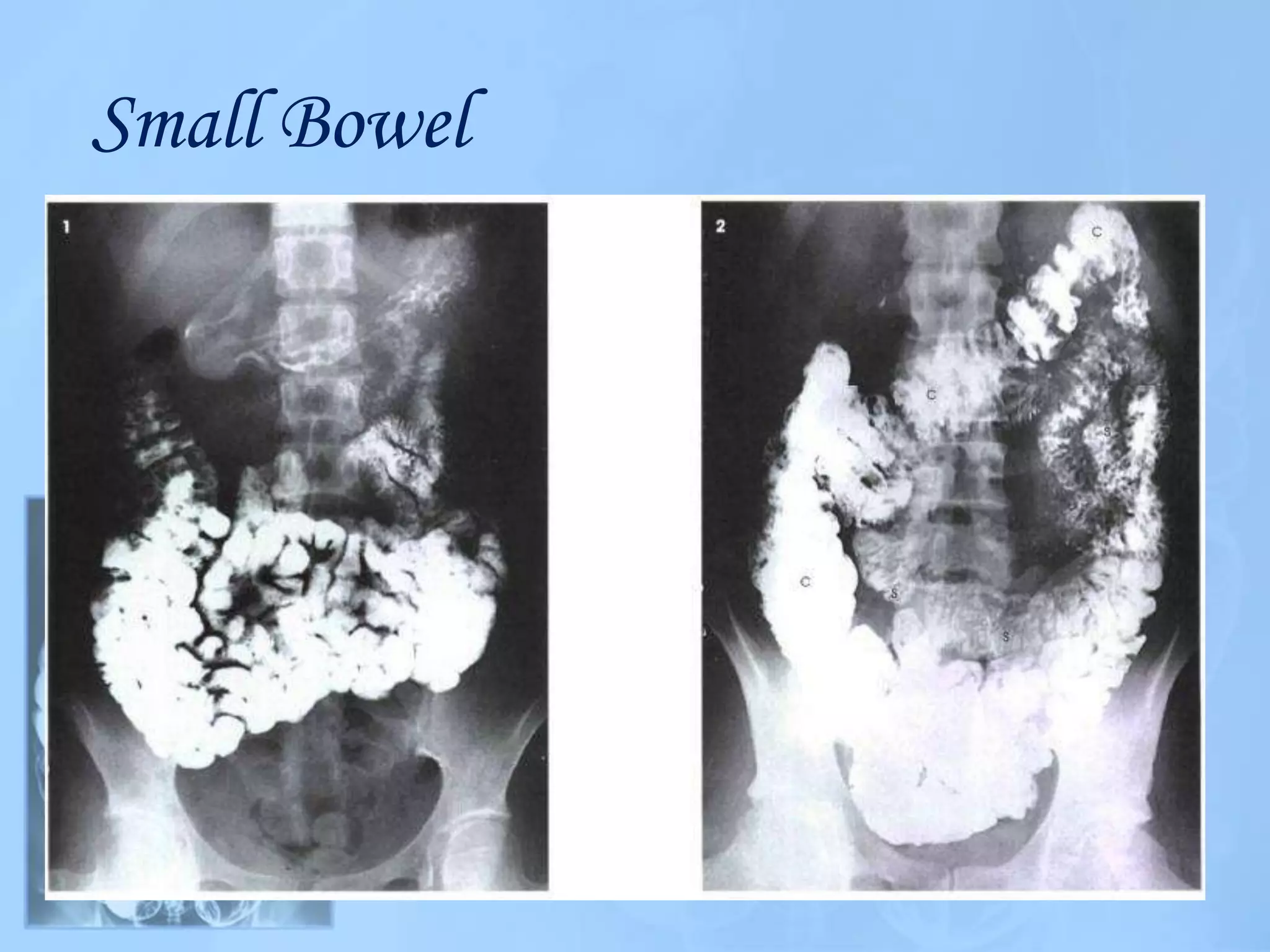 Digestive system imaging 2 class | PPT