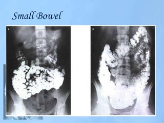 Digestive system imaging 2 class | PPTX