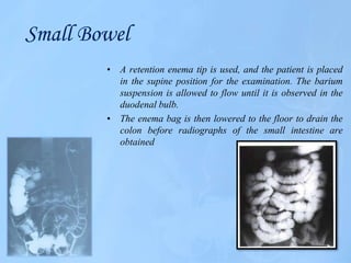 Digestive system imaging 2 class | PPTX
