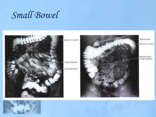 Digestive system imaging 2 class | PPT