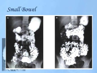 Digestive system imaging 2 class | PPT